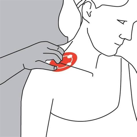 Shoulder Trigger Points Trigger Points Back Pain