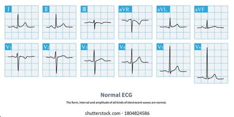 4 865 P Wave Images Stock Photos Vectors Shutterstock