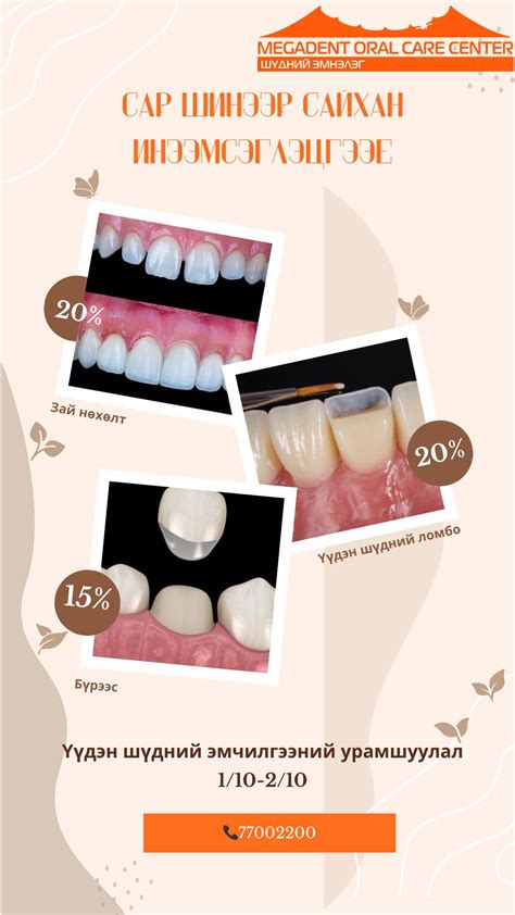 Ads Сар шинэдээ сайхан инээмсэглээрэй😁 Megadent Oral Care Center зүгээс эрхэм үйлчлүүлэгчиддээ