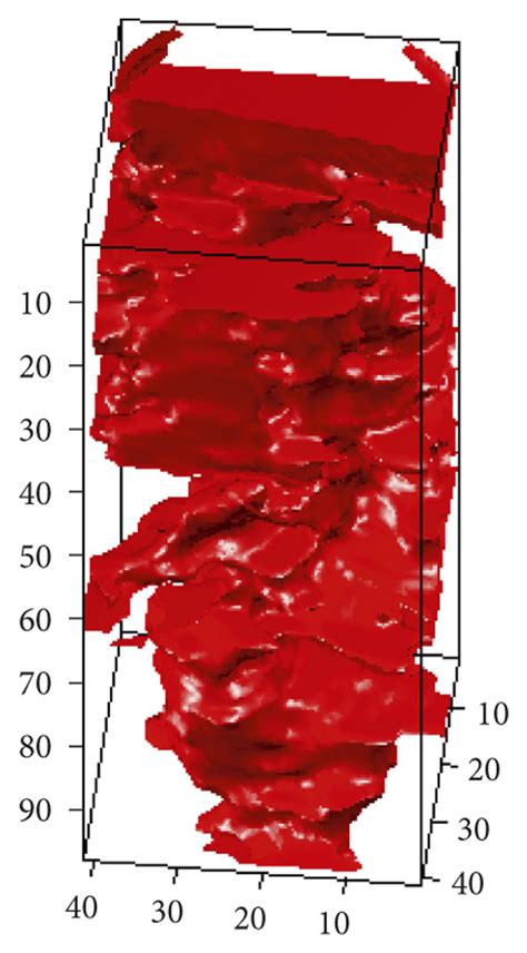 3d Tumor Segmentation Results Of Case 1 Obtained With Different