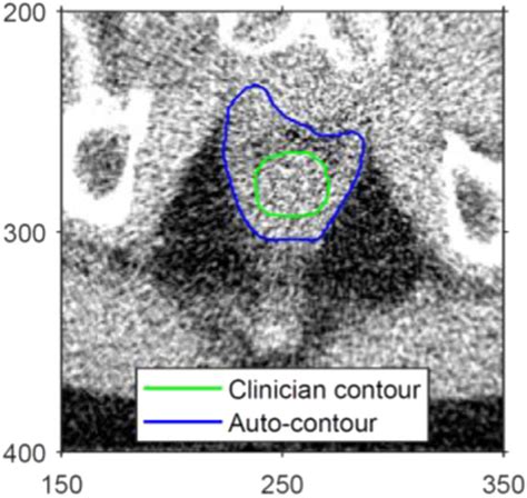 Flow Diagram Describing Autosegmentation Algorithm Download Scientific Diagram