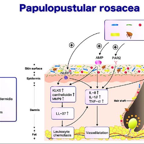 New Potential Pathophysiology Of Skin Microbiome In Rosacea Modified
