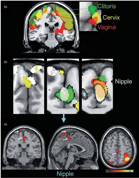 Brain Activation Patterns Derived From Fmri Scans During Stimulation Of Download Scientific