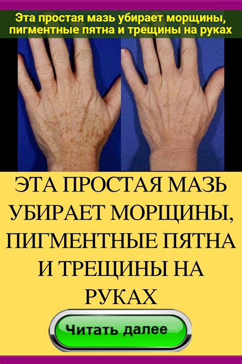 Эта простая мазь убирает морщины пигментные пятна и трещины на руках