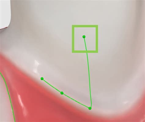 How To Draw Margin Lines Medit Help Center