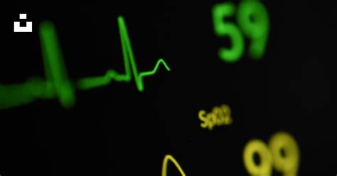 A Close Up Of A Clock With A Heartbeat On It Photo Free Medical Image