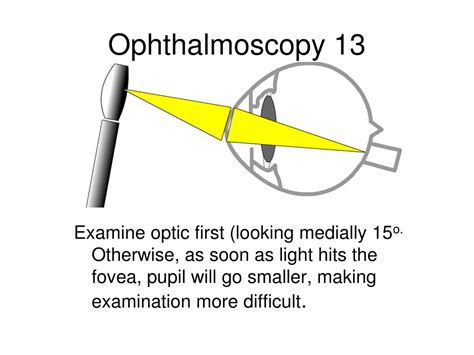 PPT Ophthalmoscopy PowerPoint Presentation Free Download ID
