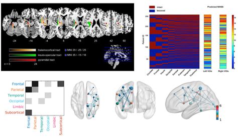 Multivariate Lesion Symptom Mapping Csi
