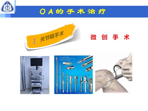 骨性关节炎的手术治疗策略，都在这篇课件里！ 好医术文章 好医术 赋能医生守护生命