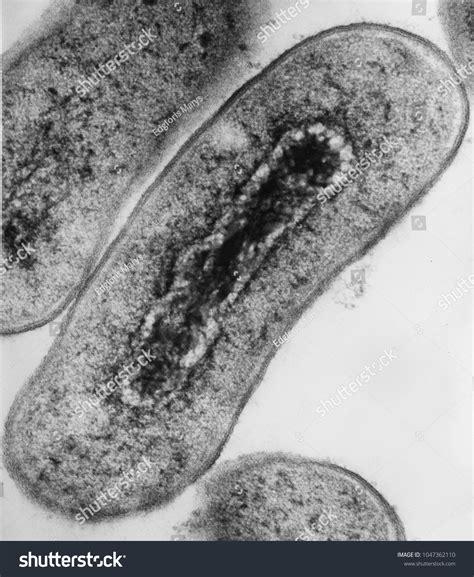 E Coli Micrograph