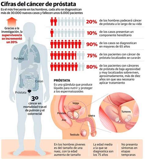 11 de junio Día Mundial del Cáncer de Próstata redinfo7 com