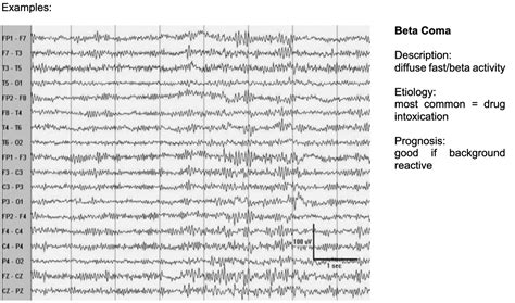 This Is Lesson 8 Of 11 In This Module