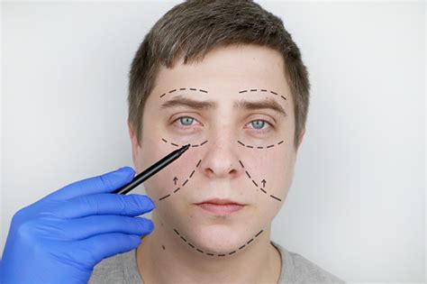 성형 외과 의사의 리셉션에서 남자 성형 수술 전 눈 썹 이 마 턱 뺨 리프트 개념에 대한 스톡 사진 및 기타 이미지 개념 개념과 주제 개선 Istock