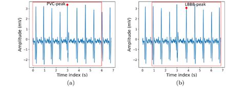 Exemplary Samples Of The Extracted Ecg Sections Download Scientific Diagram