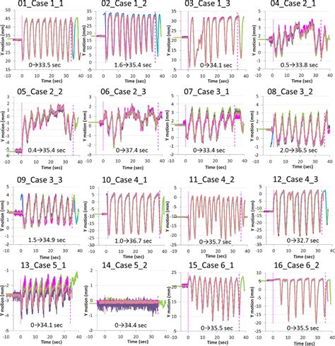 Development Of A Video Image‐based Qa System For The Positional Accuracy Of Dynamic Tumor
