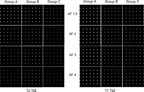 Images Showing The Hyper‐intense Points As A Function Of Phase Download Scientific Diagram