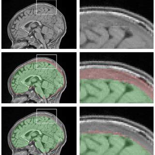 From Top To Bottom Are The Original Image The Results Of Cross Entropy Download Scientific