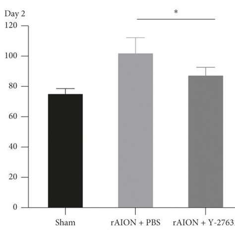 Cross Sectional Oct Images Displaying Gcc Thickness At 2 Days And 28