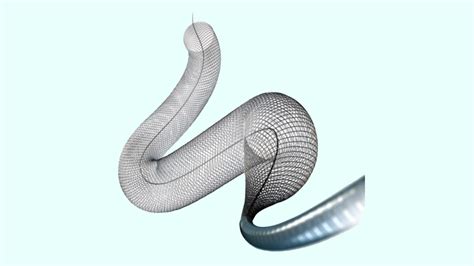 Fda Deems Medtronics Pipeline Vantage Recall ‘most Serious Modern