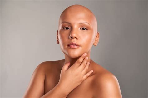 The Bald And The Beautiful Breaking The Stigma Around Female Hair Loss