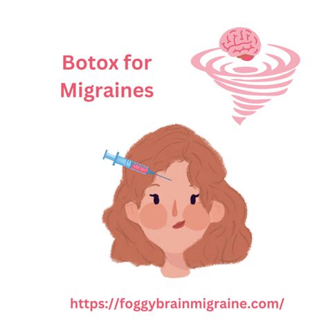 Botox For Migraines
