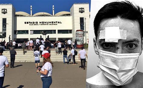 Periodista De Tvn Denuncia Agresión De Barristas De Colo Colo En El