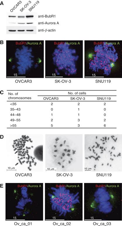 Assessing Bubr1 And Aurora A Levels And Localisation In Ovarian Cancer