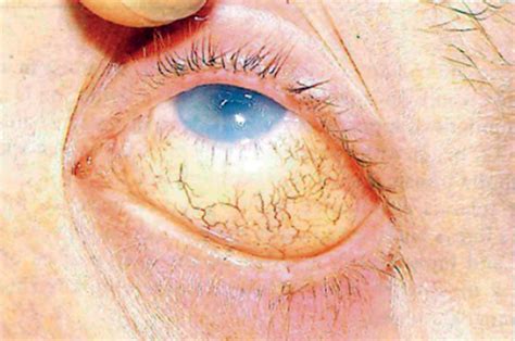 Principles Of Management Eye News