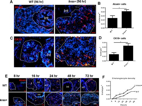Increase Of Cholangiocytes Upon Induction Of Oncogenic Krasv12