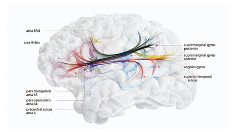 visualizing node link graphs an essay on how to make graphs easier