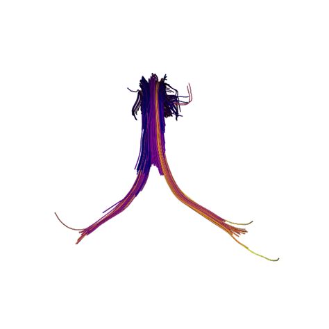 Enhancing Quickbundles With Different Metrics And Features — Dipy 111