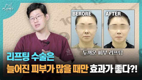 리프팅 수술하고 싶은데 여분의 피부가 없을 때는 Youtube