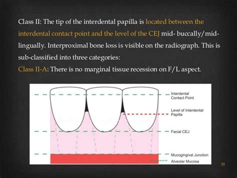Gingival Recession Classifications