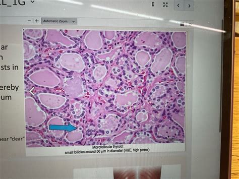 Psio 202 Lab Endocrine System Flashcards Quizlet