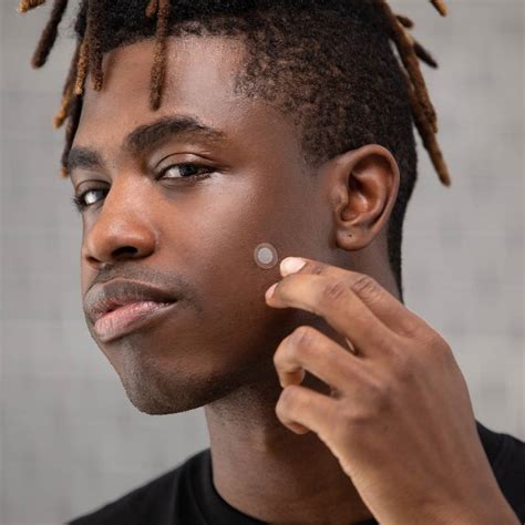 Prickly Pimple Patch By Cardon Get Rid Of Acne And Pimples Overnight