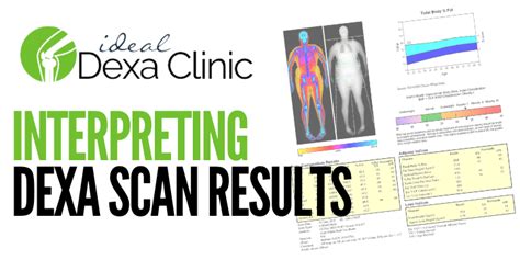 Interpreting DEXA Scan Results A Comprehensive Guide