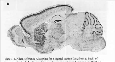 2 3 2 Allen Atlas Reference Plate Showing Calb1 Gene Expression In Download Scientific Diagram