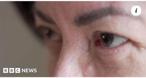 Doctors Failed To Warn Women Of Risky Sex Drug Urges