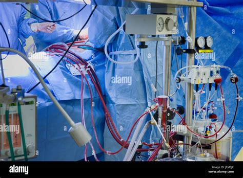 Cardiopulmonary Bypass
