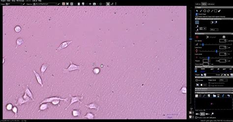 Isolating And Re Growing Living Cells With Laser Microdissection