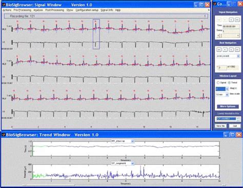 Figure 1 From Biosigbrowser Biosignal Processing Interface Semantic Scholar