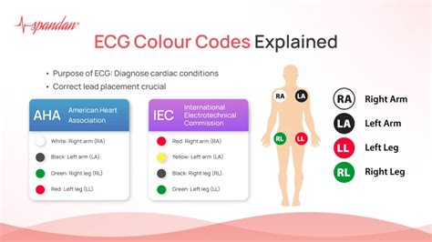 Ecg Colour Codes Explained