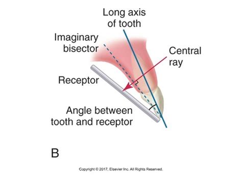Bisecting Technique Flashcards Quizlet