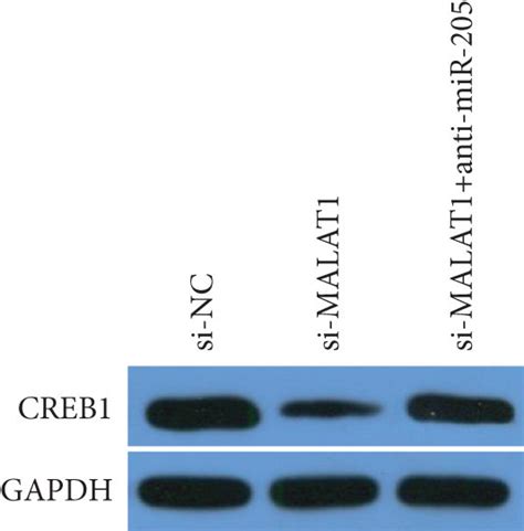 Malat1 Exerts A Biological Role In Mgcs By Regulating The Mir 205 Creb1 Download Scientific