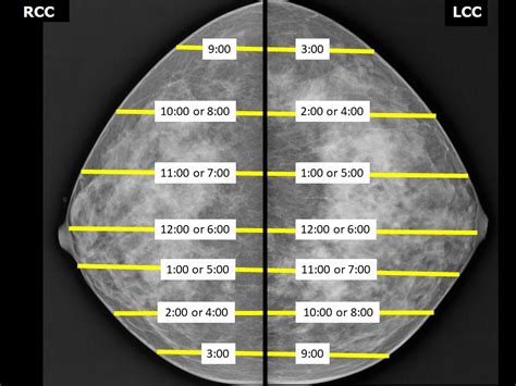 Atlas Of Breast Cancer Early Detection