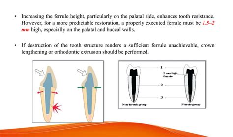 Rehabilitation Of Endodontically Treated Teeth Post And Core Pptx