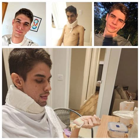 Tia Busca Ajuda Para Sobrinho De 21 Anos Que Sofre Com Um Câncer Chamado Sarcoma De Ewing São