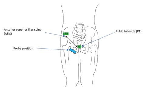 Obturator Nerve