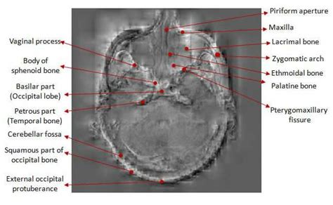 Foreground Segmentation Download Scientific Diagram