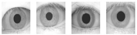 examples of iris images from the casia database